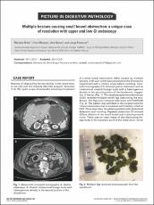 Multiple bezoars causing small bowel obstruction : a unique case of ...